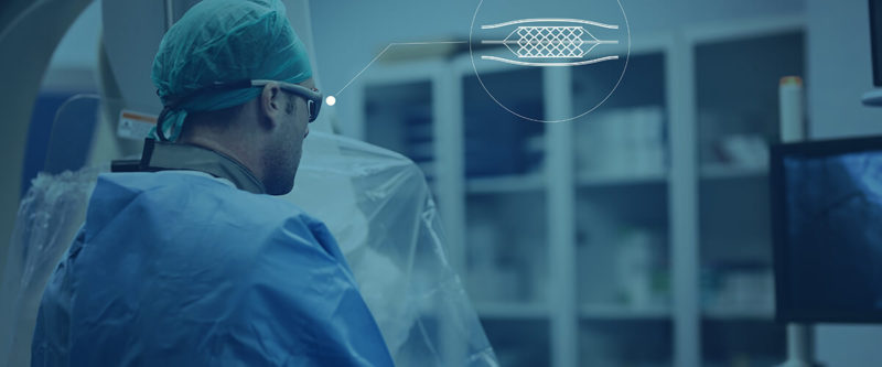 Peripheral Vascular Angioplasty and Stenting – CardioVSurgical